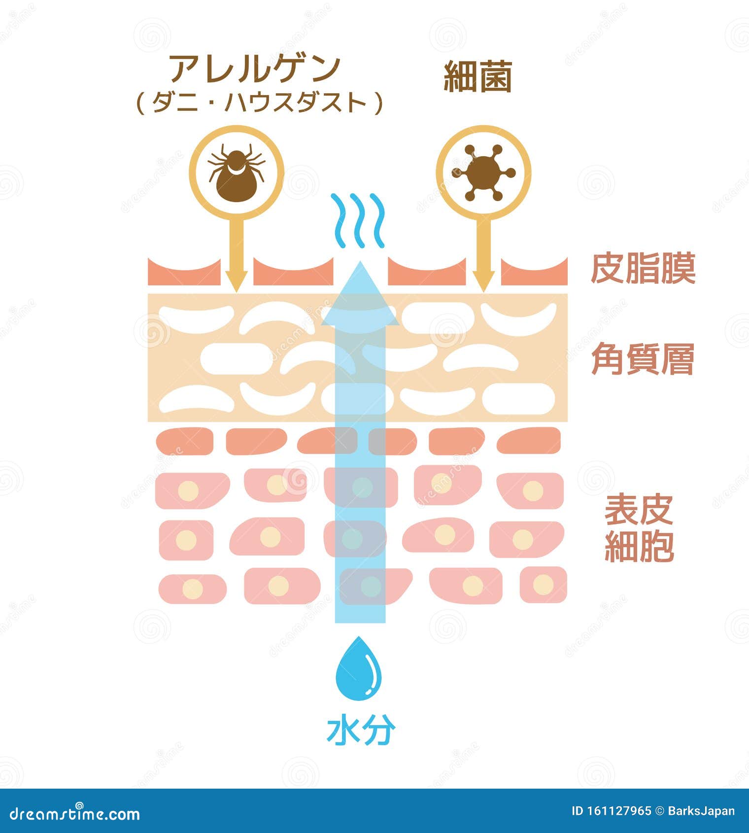 Sectional View of the Skin. Illustration of Damaged Skin. Stock Vector ...