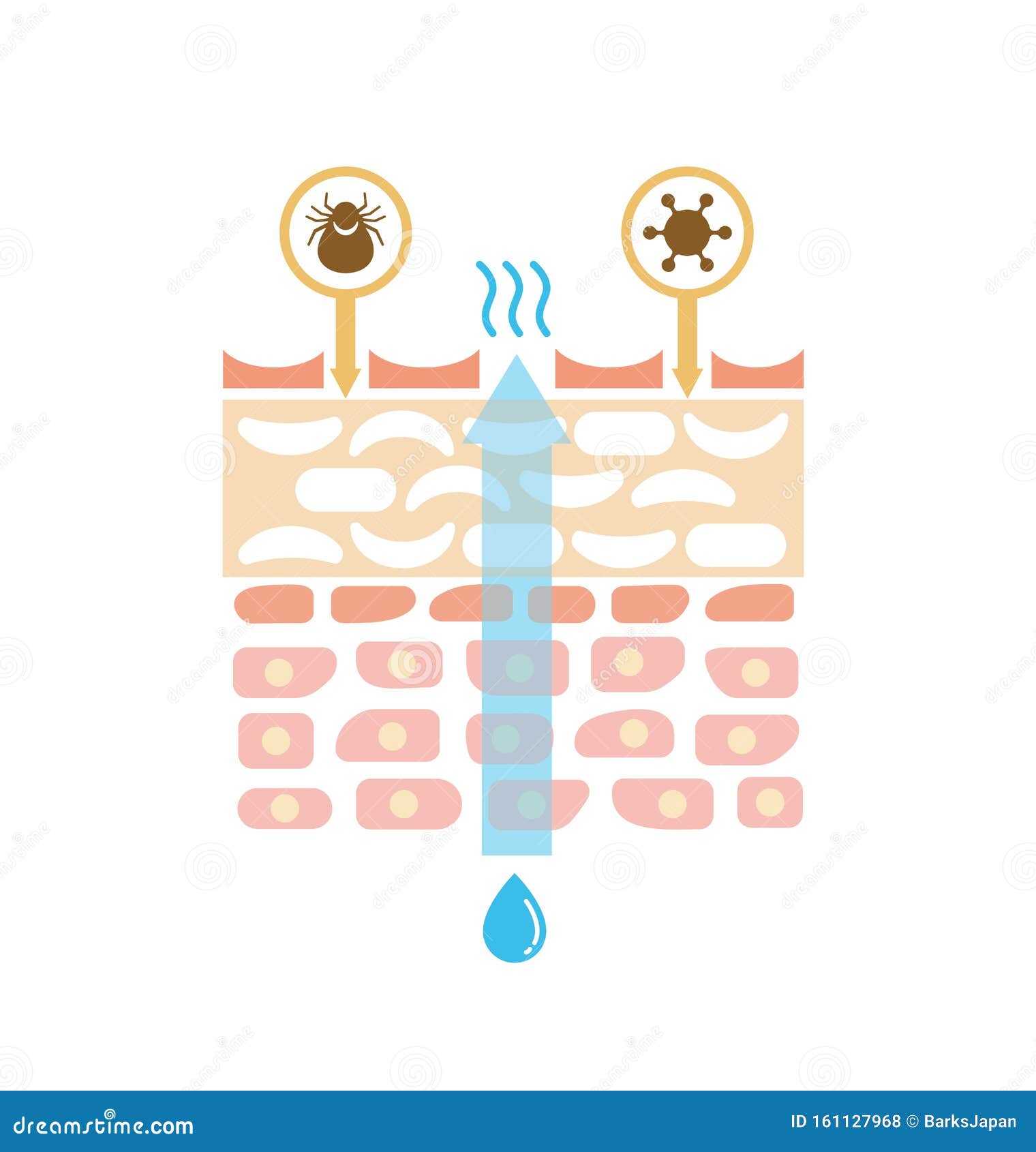 Sectional View of the Skin. Illustration of Damaged Skin. Stock Vector ...