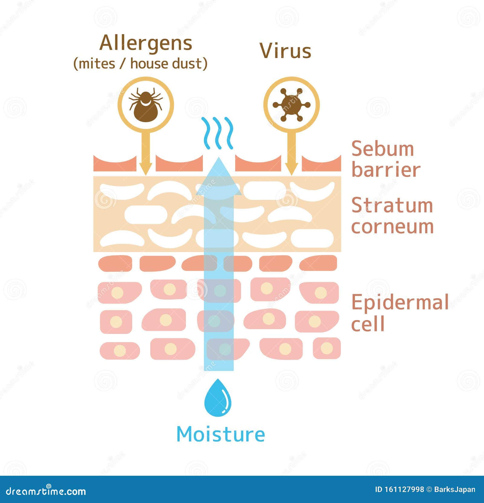 Sectional View of the Skin. Illustration of Damaged Skin. Stock Vector ...
