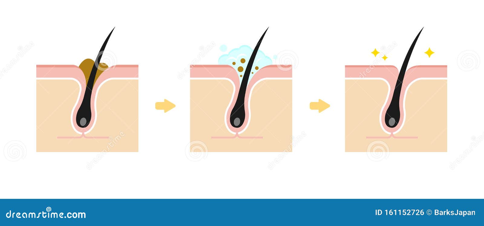 Structure Illustration of Pores Cleansing Stock Vector - Illustration ...