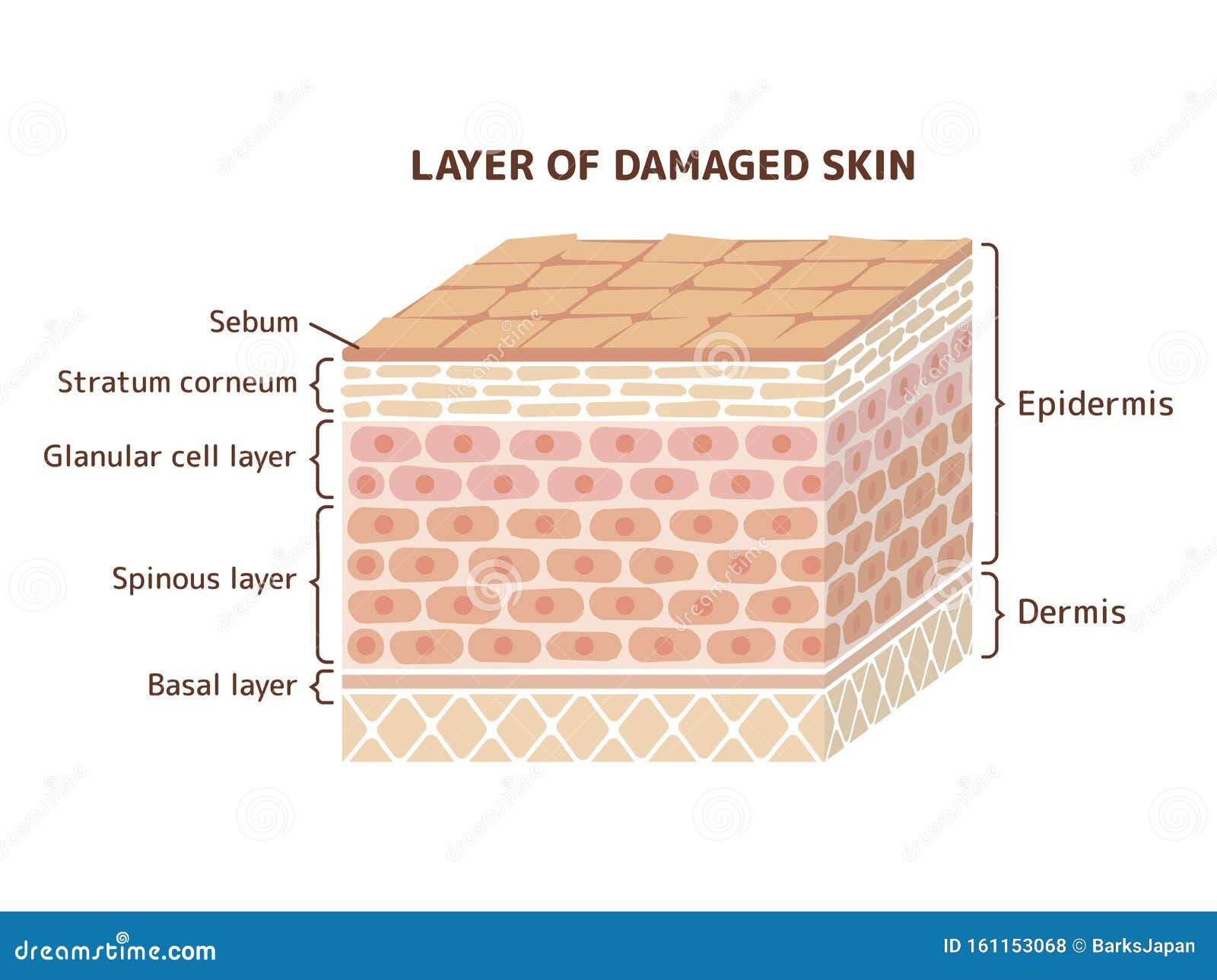 Layer of Human Damaged Skin 3D Illustration / English Stock Vector ...