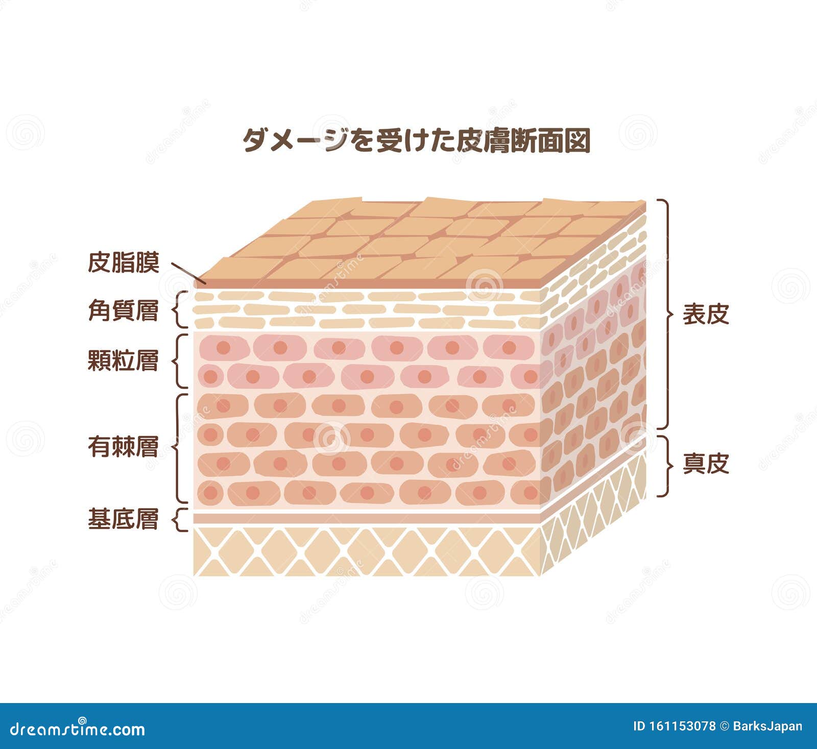 Layer of Human Damaged Skin 3D Illustration / Japanese Stock Vector ...