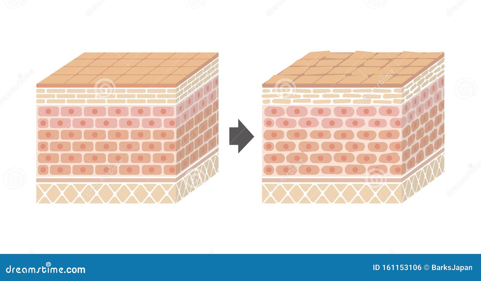 3D Comparison Illustration of Protection Effect between Healthy Skin ...