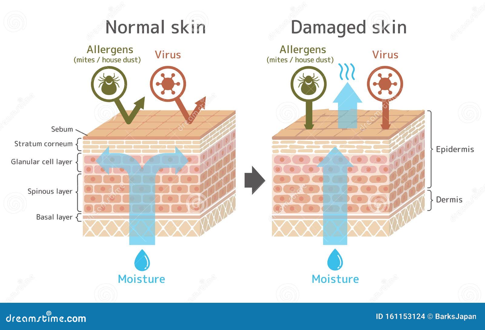 3D Comparison Illustration of Protection Effect between Healthy Skin ...