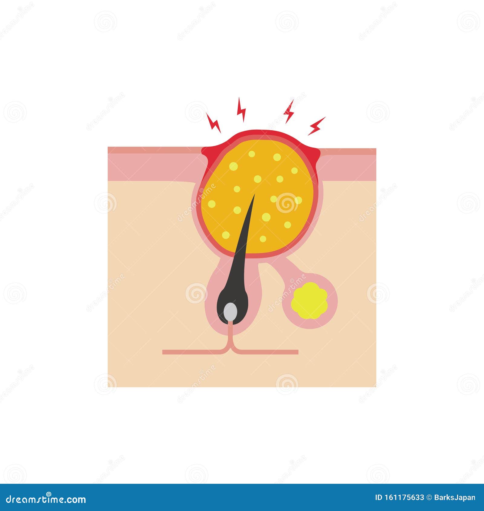 Healthy Pores And Sebum. Sebaceous Glands Produce Right Amount Of Sebum ...