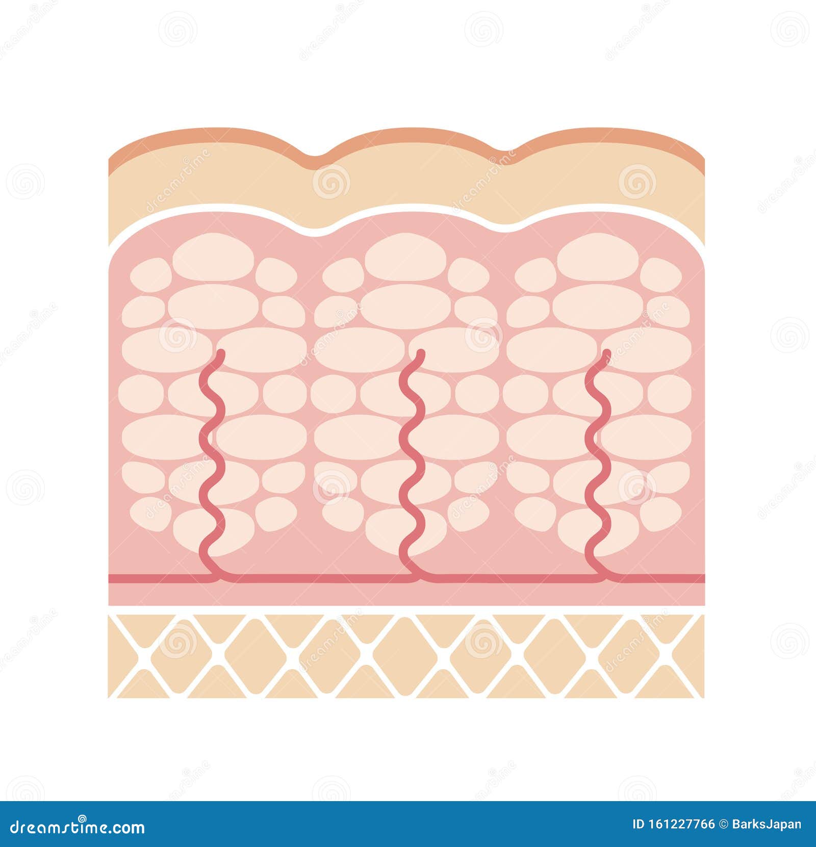 Cellulite`s Skin Vector Illustration Stock Vector - Illustration of ...