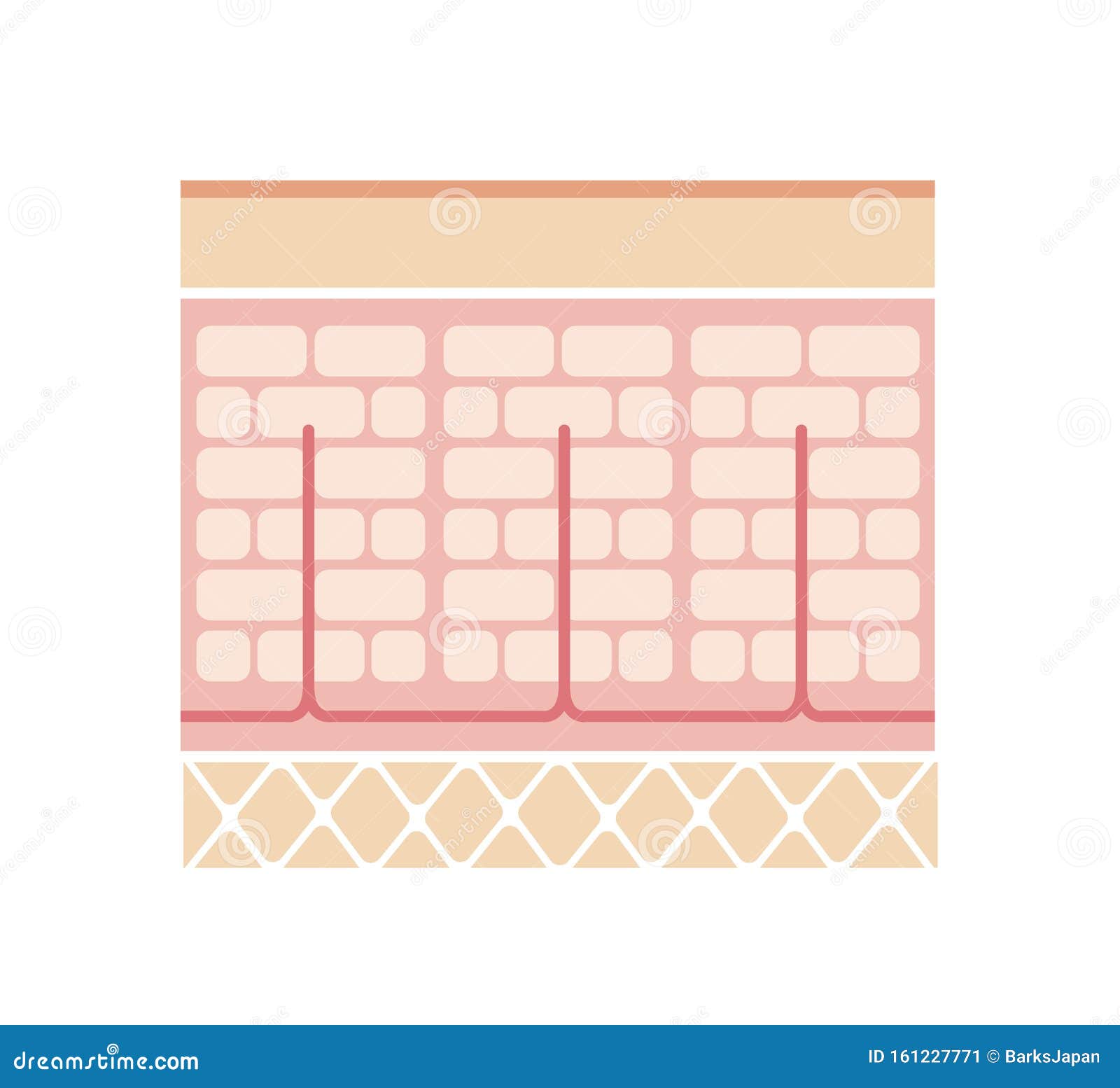 Normal Skin And Cellulite. Illustration With Symbols Cartoon Vector ...