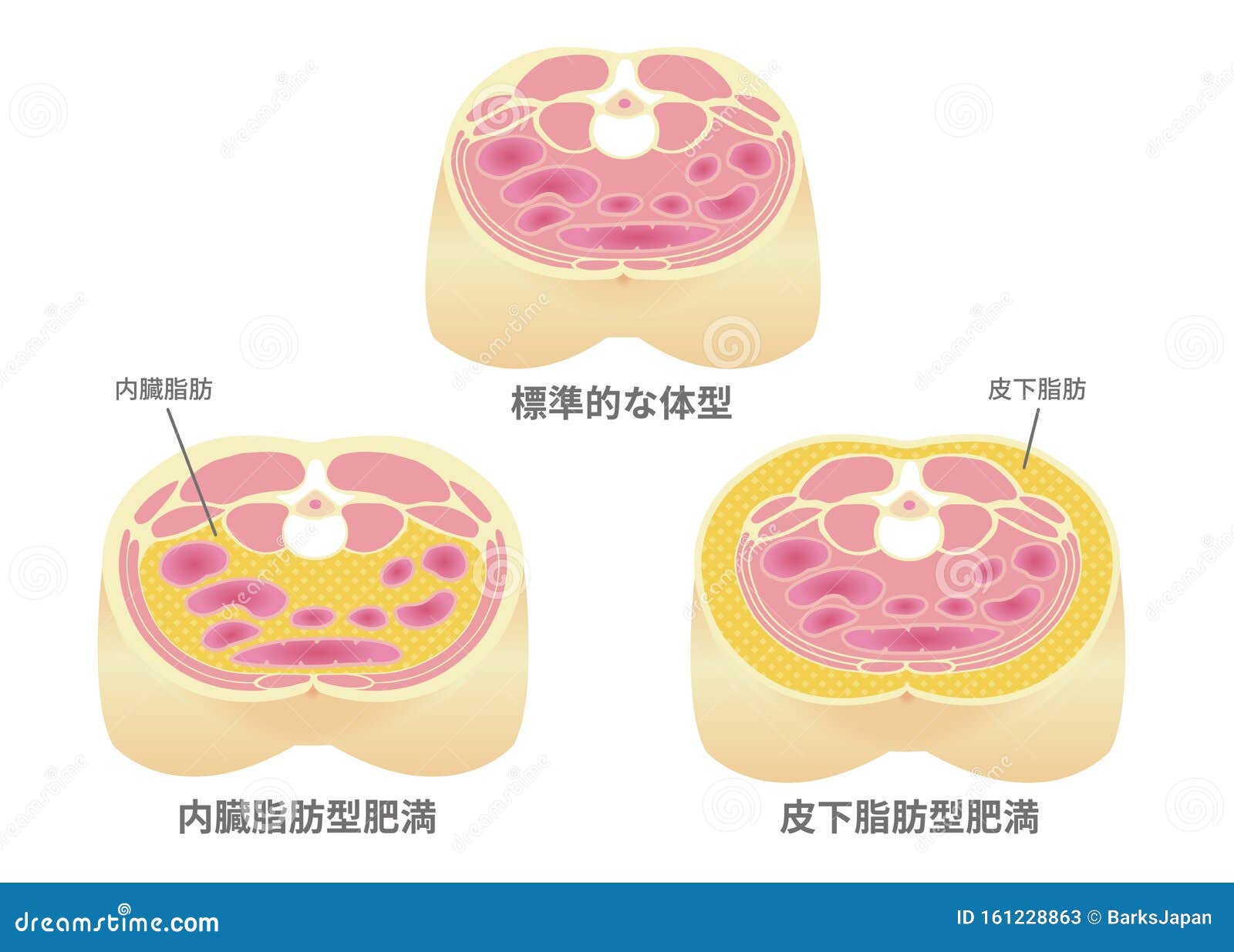 Visceral And Subcutaneous Fat Around Waistline. Location Of Visceral ...