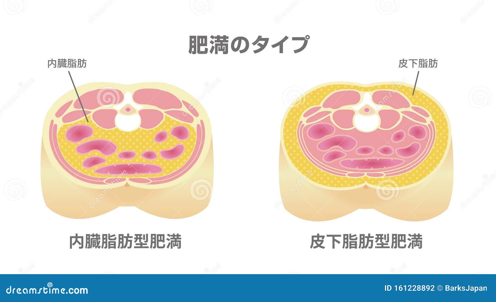 Visceral And Subcutaneous Fat Around Waistline. Location Of Visceral ...