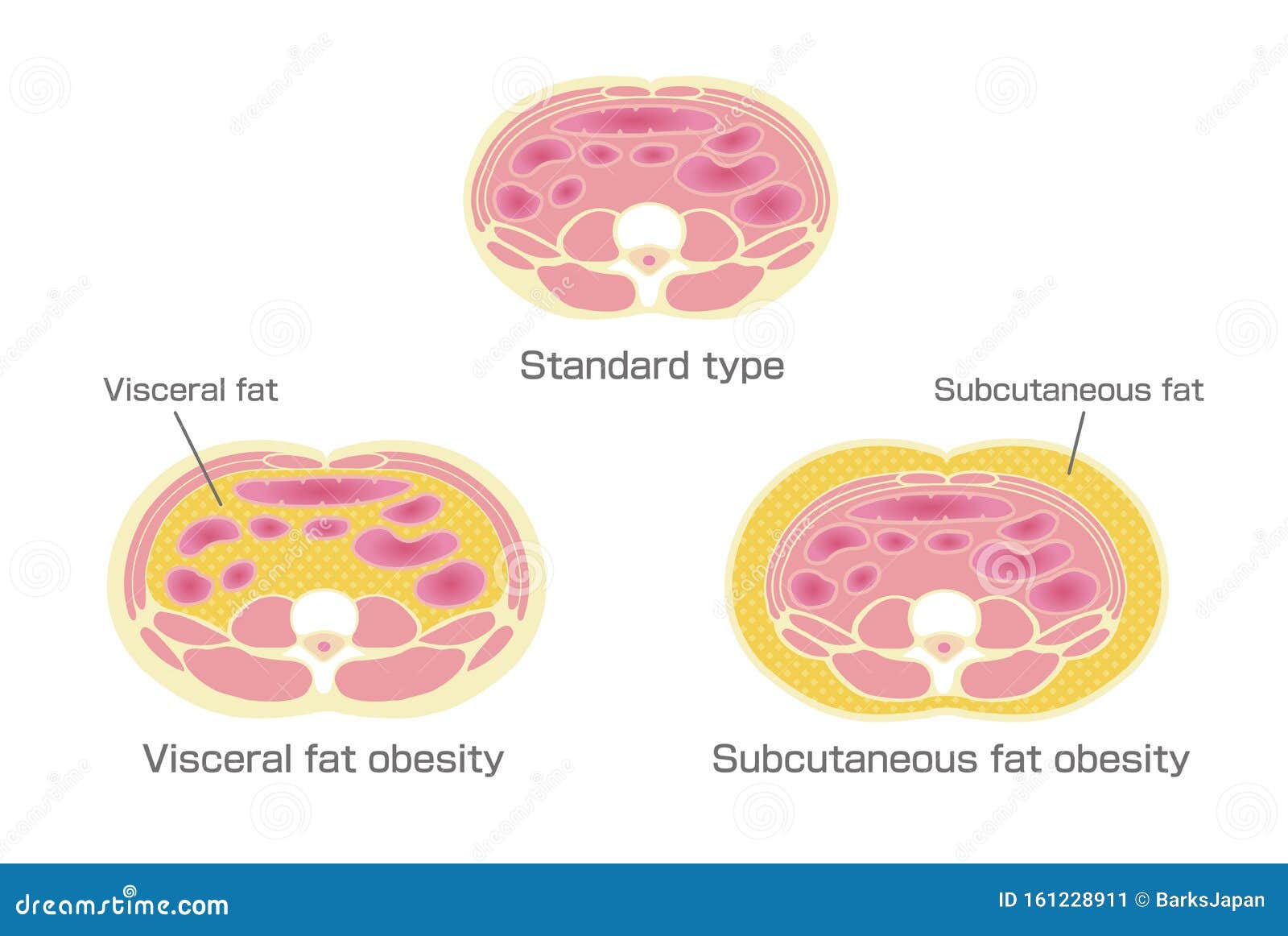 Subcutaneous Fat Contusion Ultrasound Image