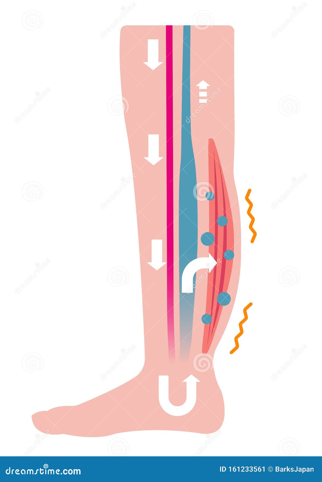Cause of Swelling, Edema of the Legs. / No Text Stock Vector ...