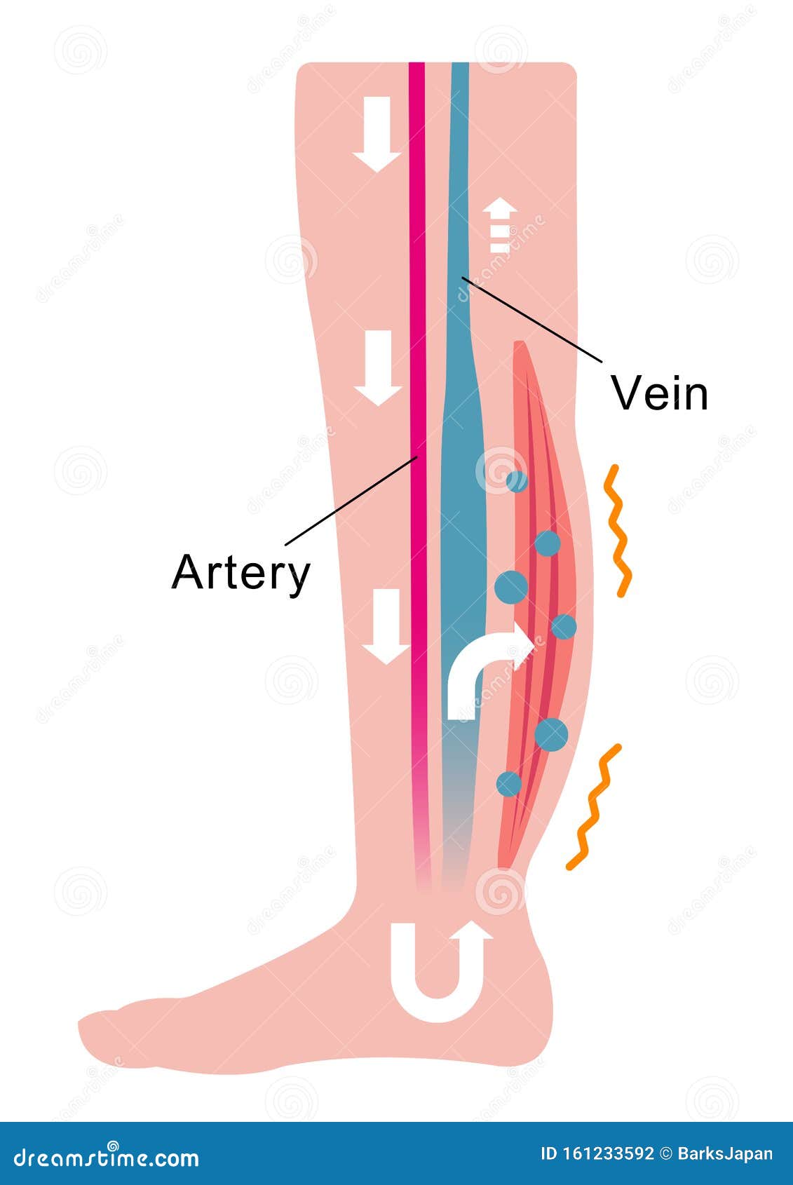 Cause Of Swelling, Edema Of The Legs. / No Text Cartoon Vector ...