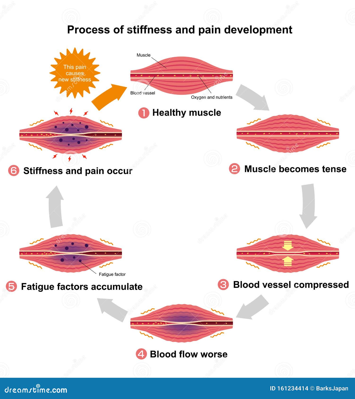 Stiffness Cartoons, Illustrations & Vector Stock Images - 1681 Pictures ...
