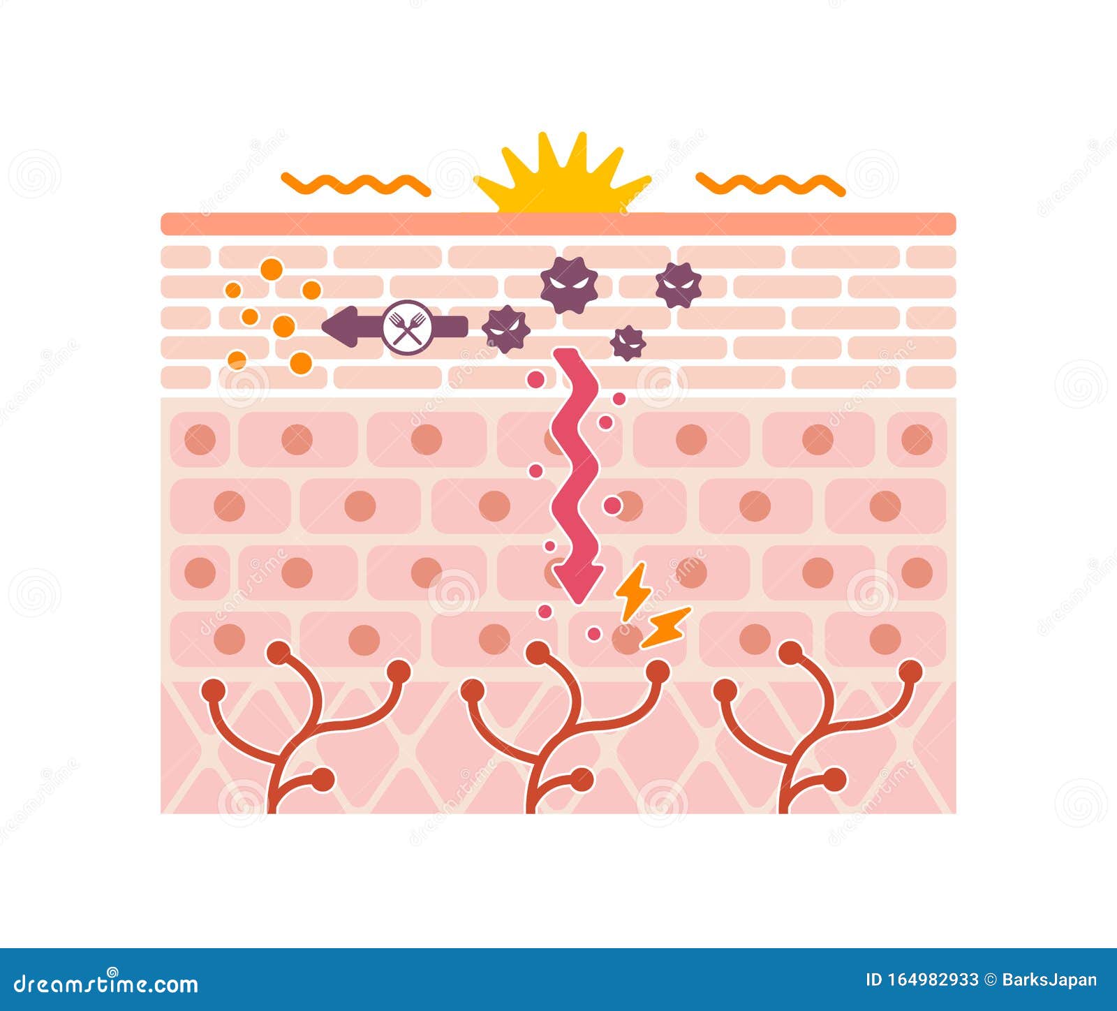 Ringworm Vector Illustration. Labeled Fungal Skin Infection Example ...