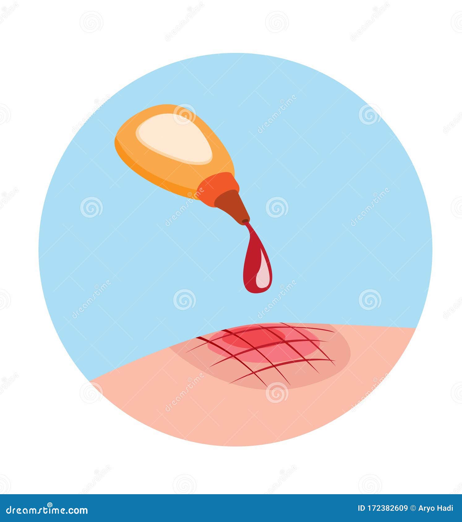 Betadine On Scar, Iodin Povidon Liquid To Anti Septic From Scratch Skin ...