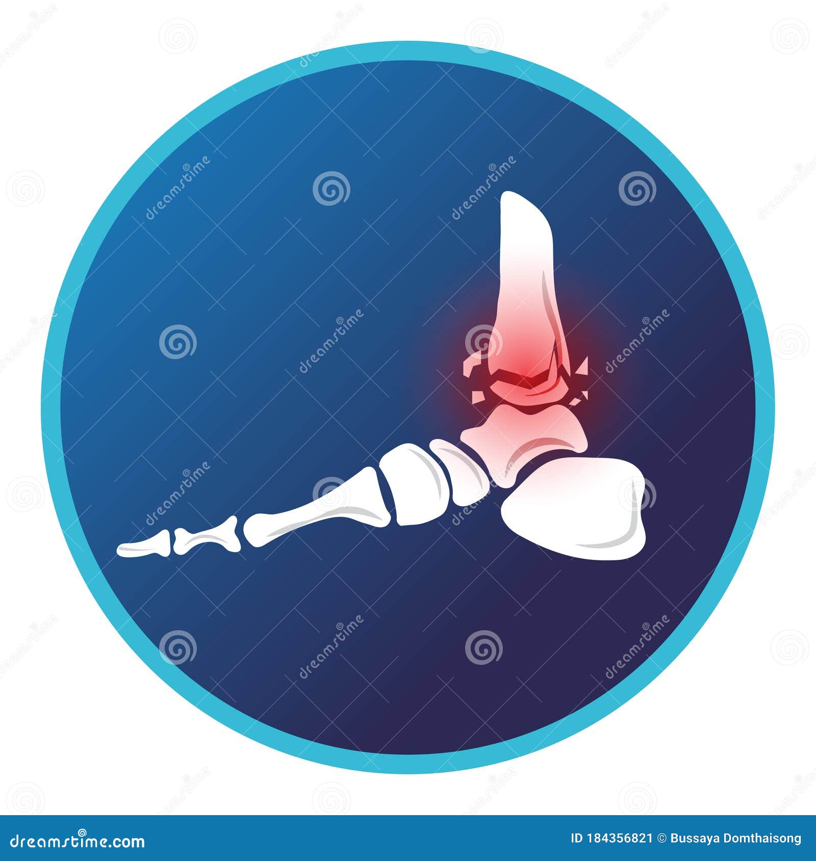 Fracture Ankle Icon. Vector Flat Design for Radiology Orthopedic ...