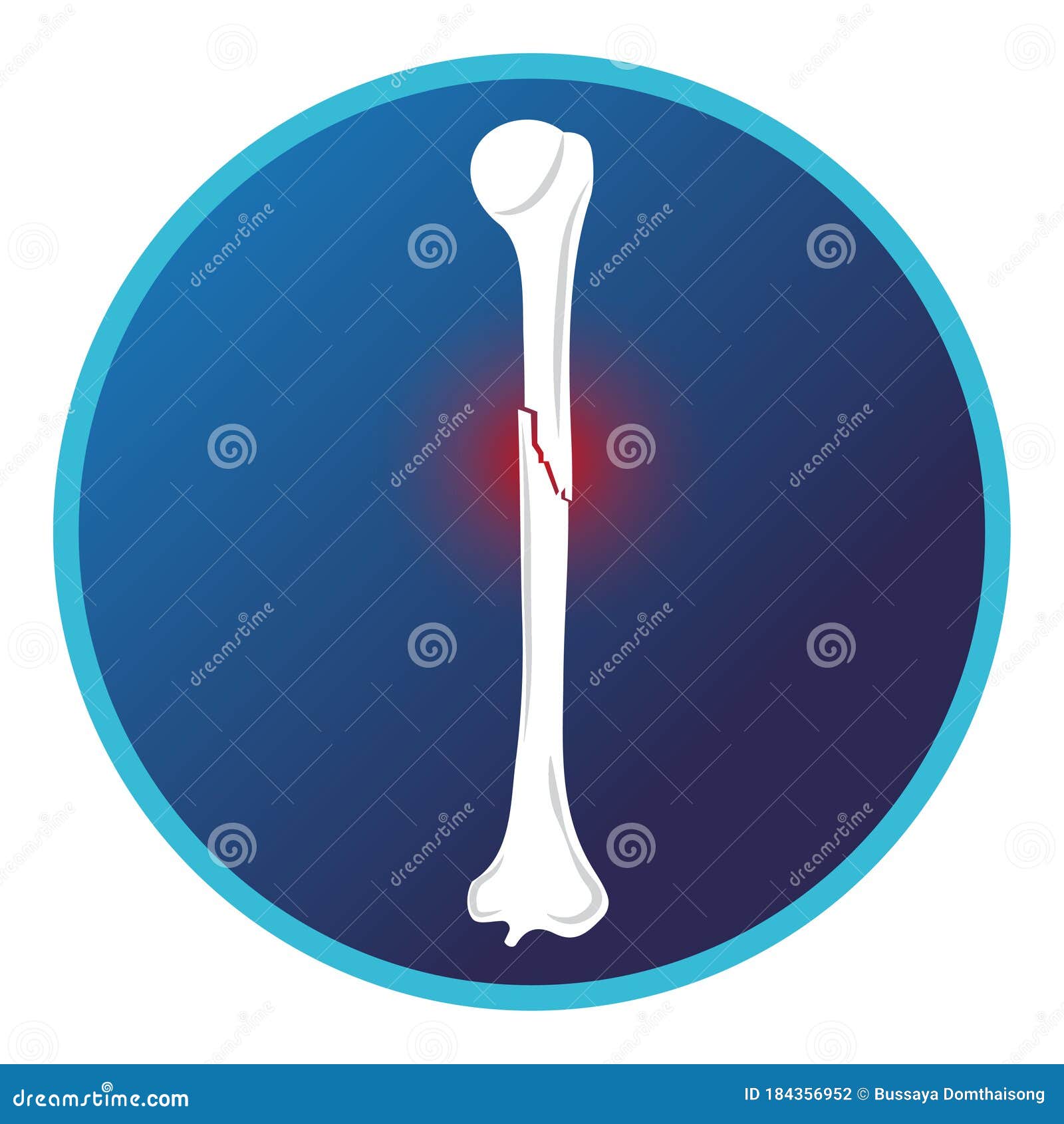 Humerus Distal Inferior View Royalty-Free Stock Image | CartoonDealer ...