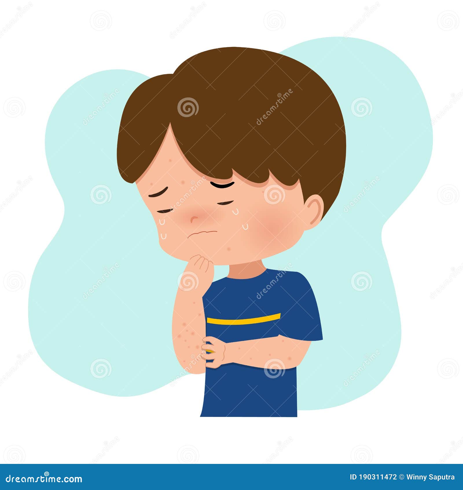 Chickenpox. Varicella. Face Of A Child With Skin Rash Cartoon Vector ...