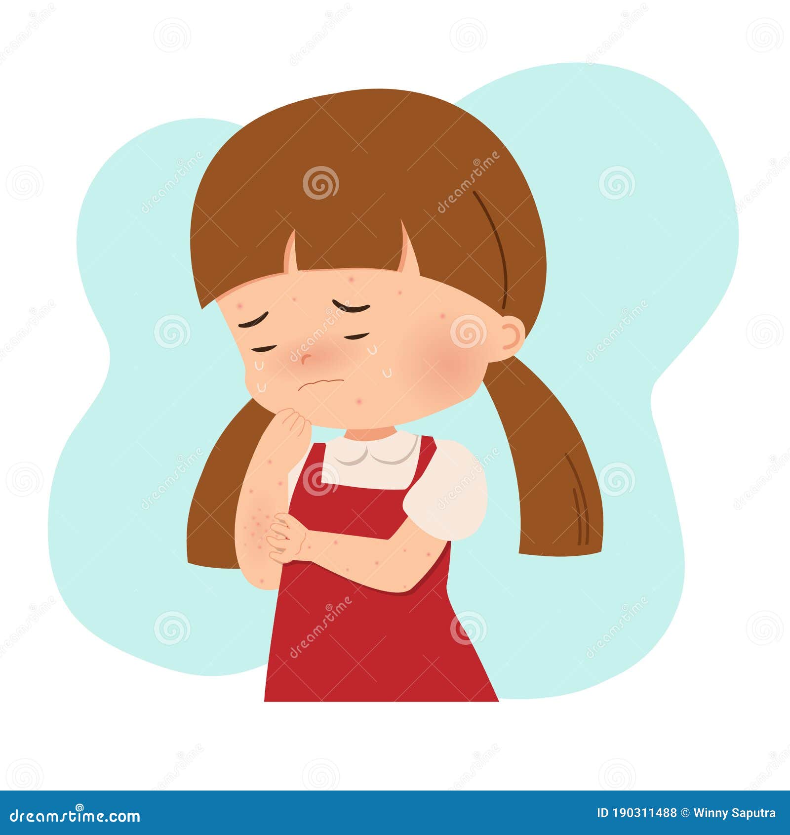 Girl Scratching Itching Rash On His Body . Vector Illustration ...