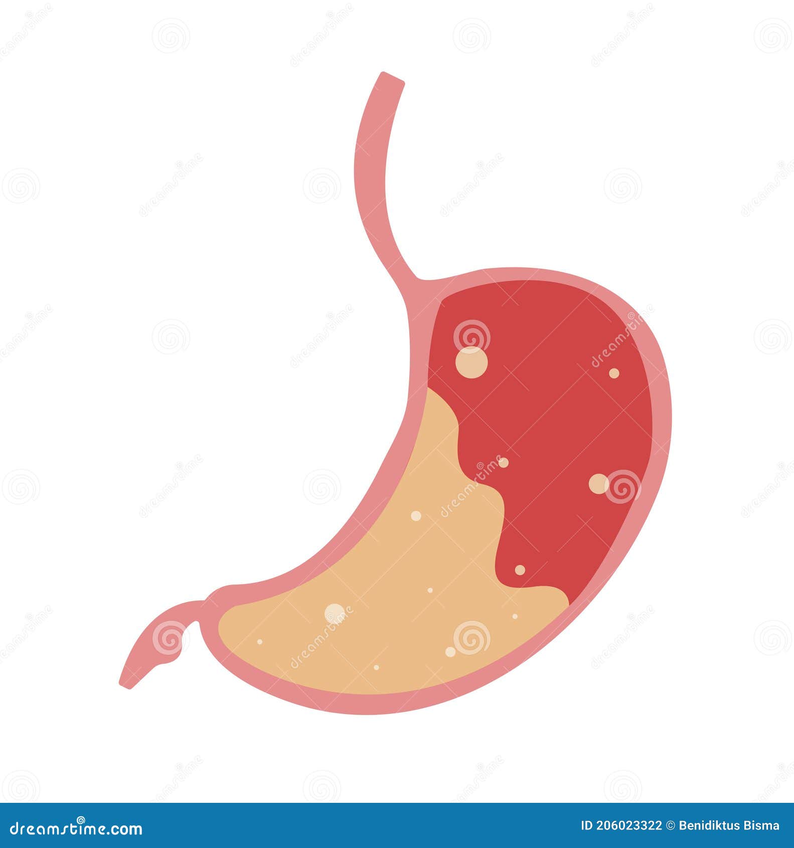 Stomach or Abdominal Bloating Flat Illustration Stock Vector ...