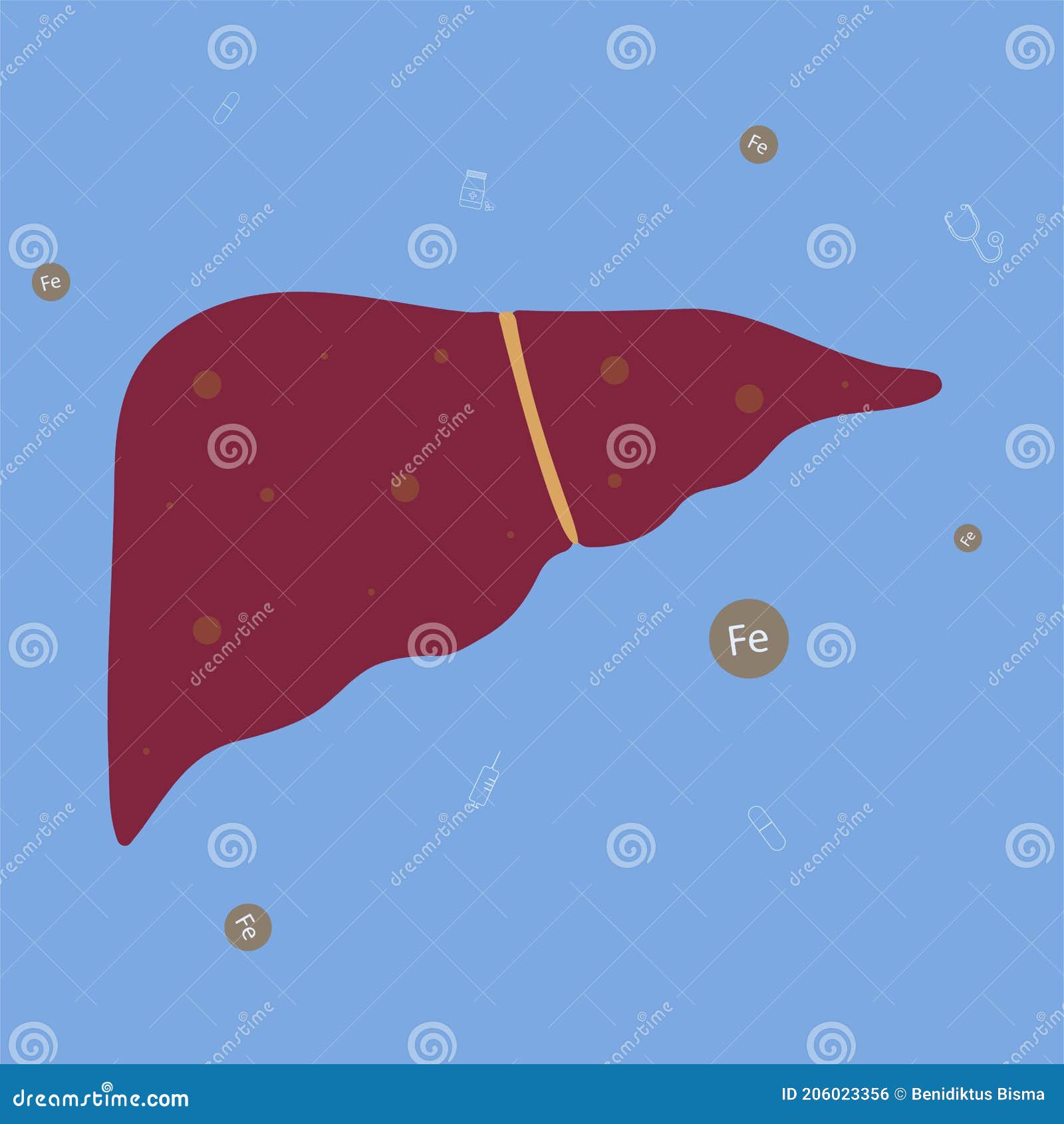 Hemochromatosis Or Iron Overload. Healthy Liver And Liver With Iron ...