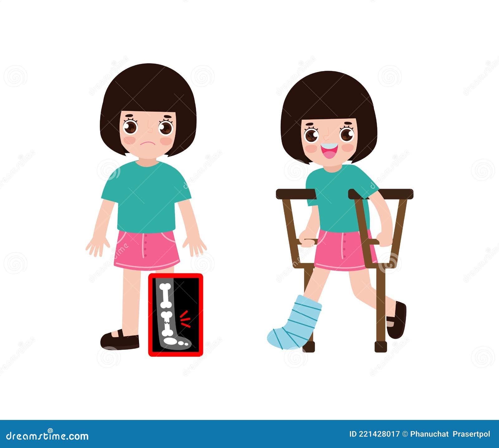 Cute Cartoon Asian Children With Broken Leg On X-ray And Recovering ...