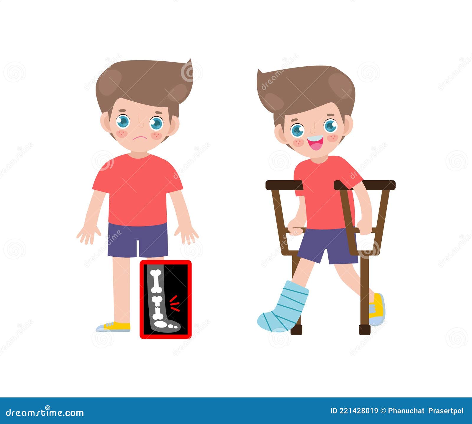 Broken Bone Xray Cartoon