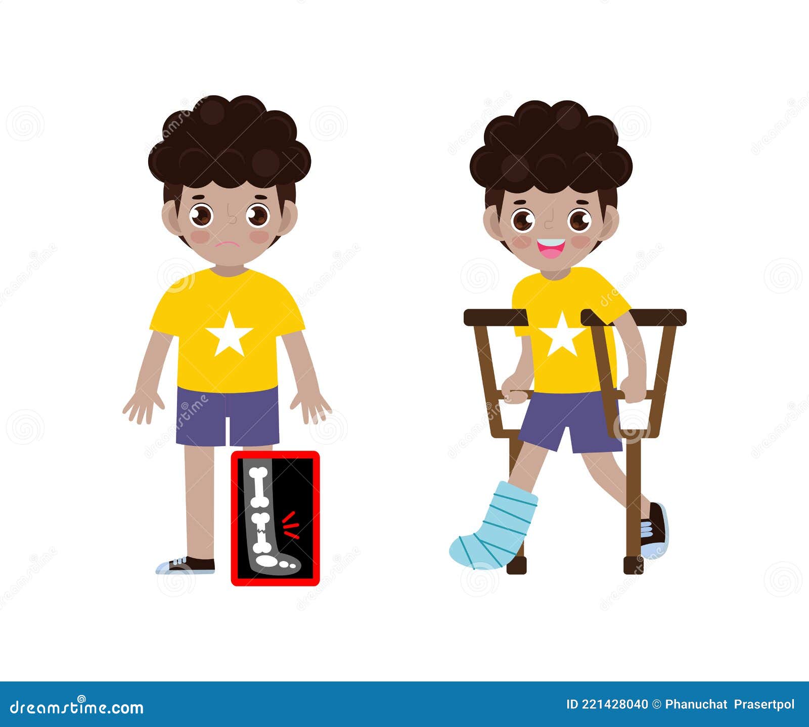 Cute Cartoon Caucasian Children with Broken Leg on X-ray and Recovering ...