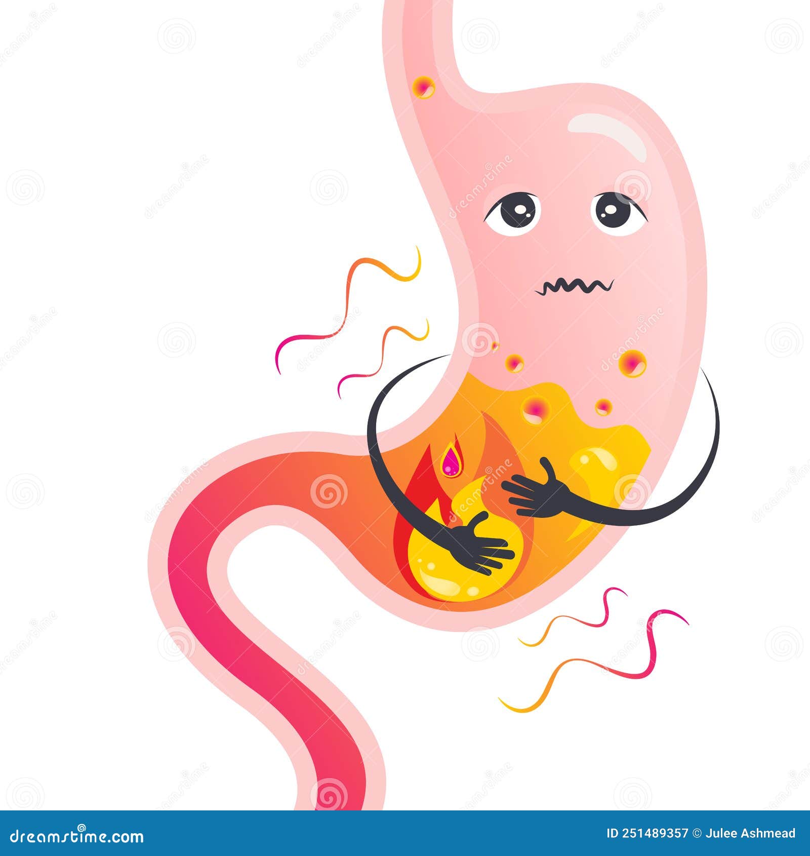 Stomach With A Burning Acid Bile. Vector Illustration In Cartoon Style ...