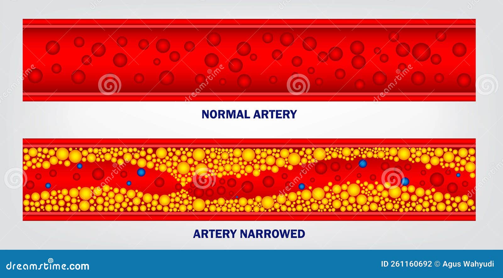 Cholesterol HDL Type. Good Cholesterin Concept. High-density ...