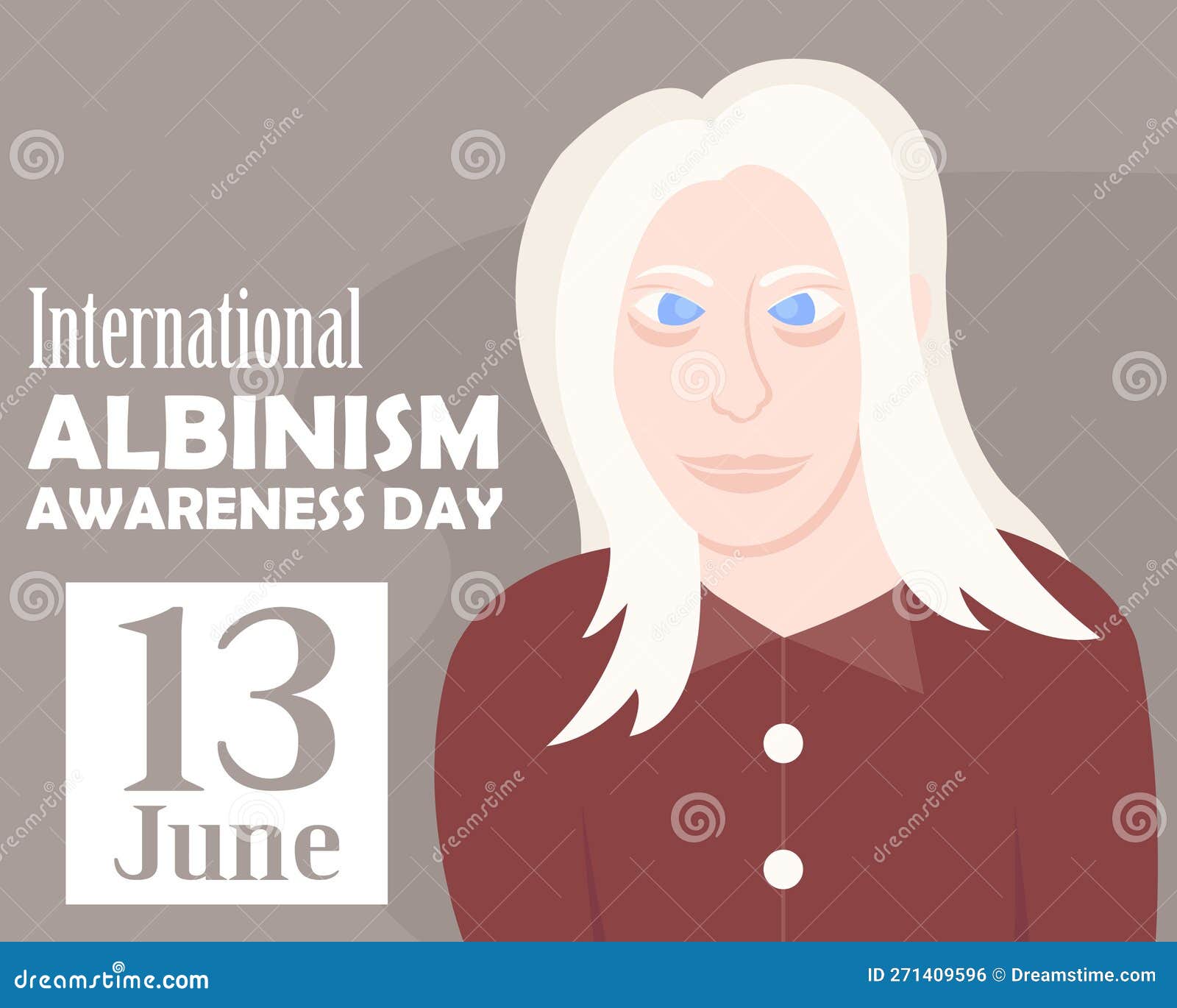 Pretty Albino Girl Portrait,blond Hair.Albinism.Genetic Rare Disorder ...