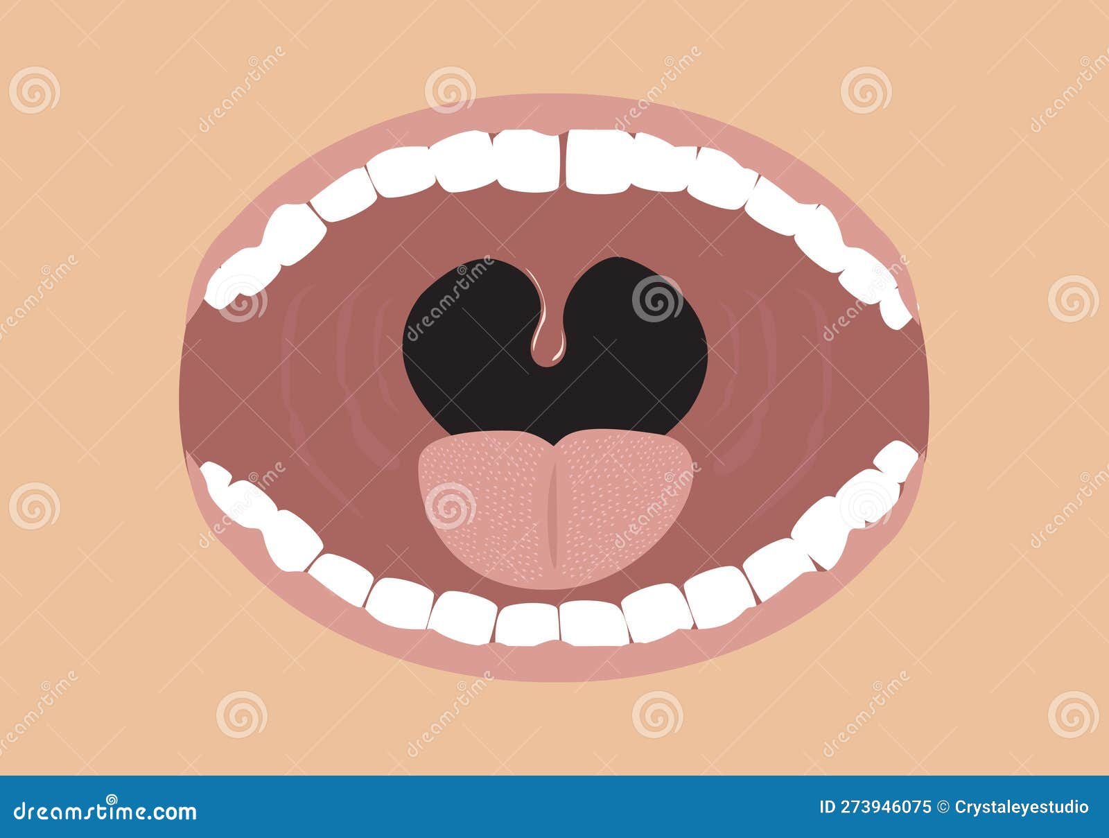 Opened Mouth Concept With Tonsils Shown. Editable Clip Art. Cartoon ...