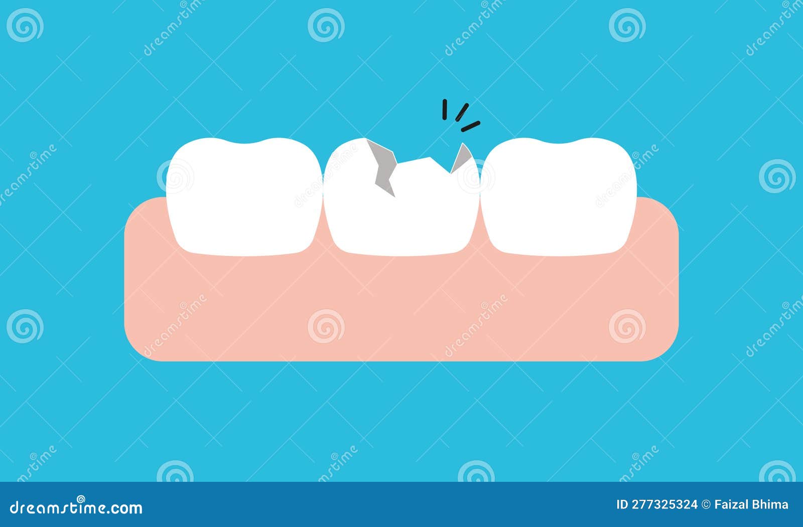 Broken White Teeth and Gums Stock Vector - Illustration of medicals ...