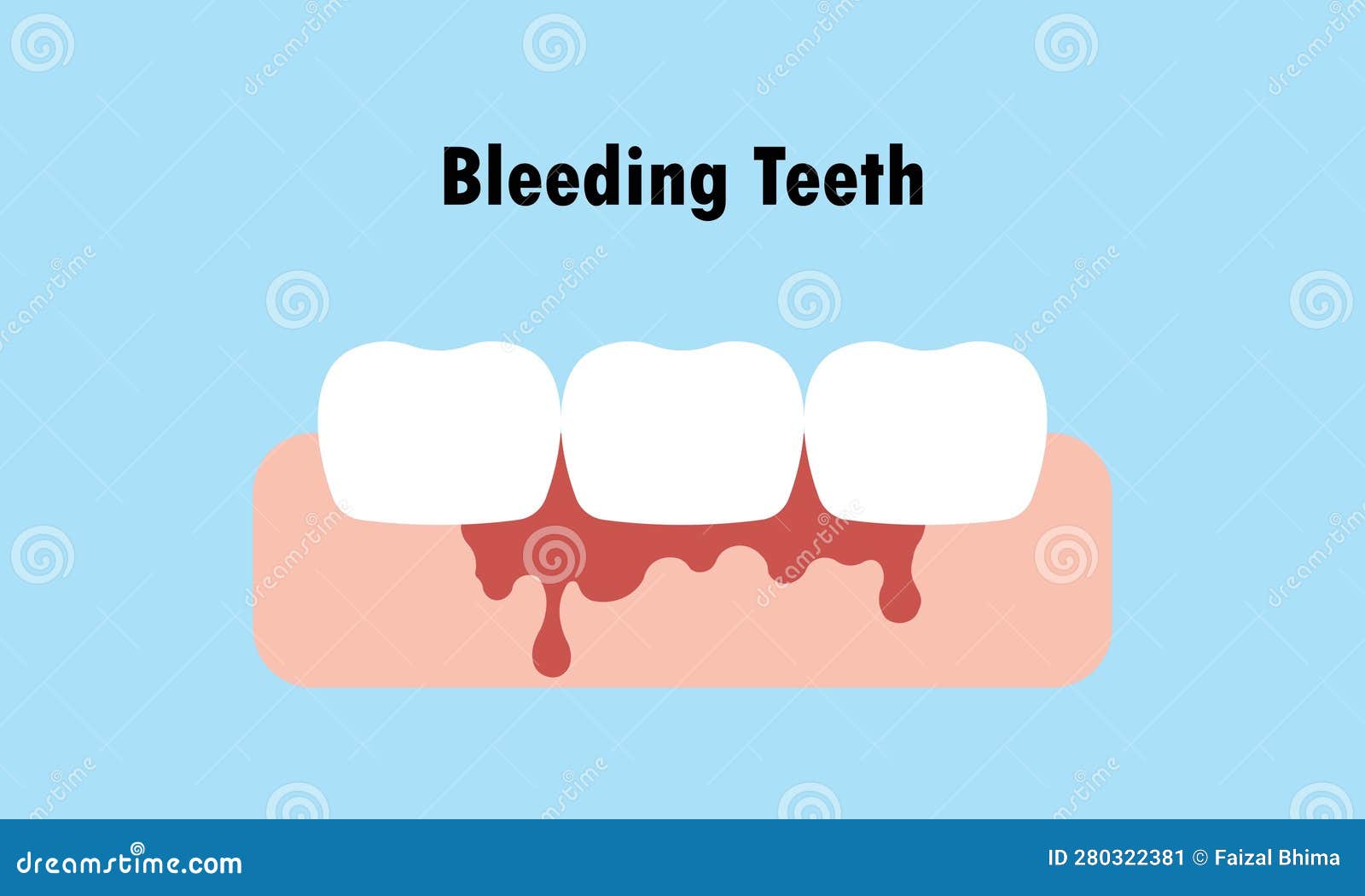 Bleeding White Teeth while Cleaning because Brushing with Toothbrush ...