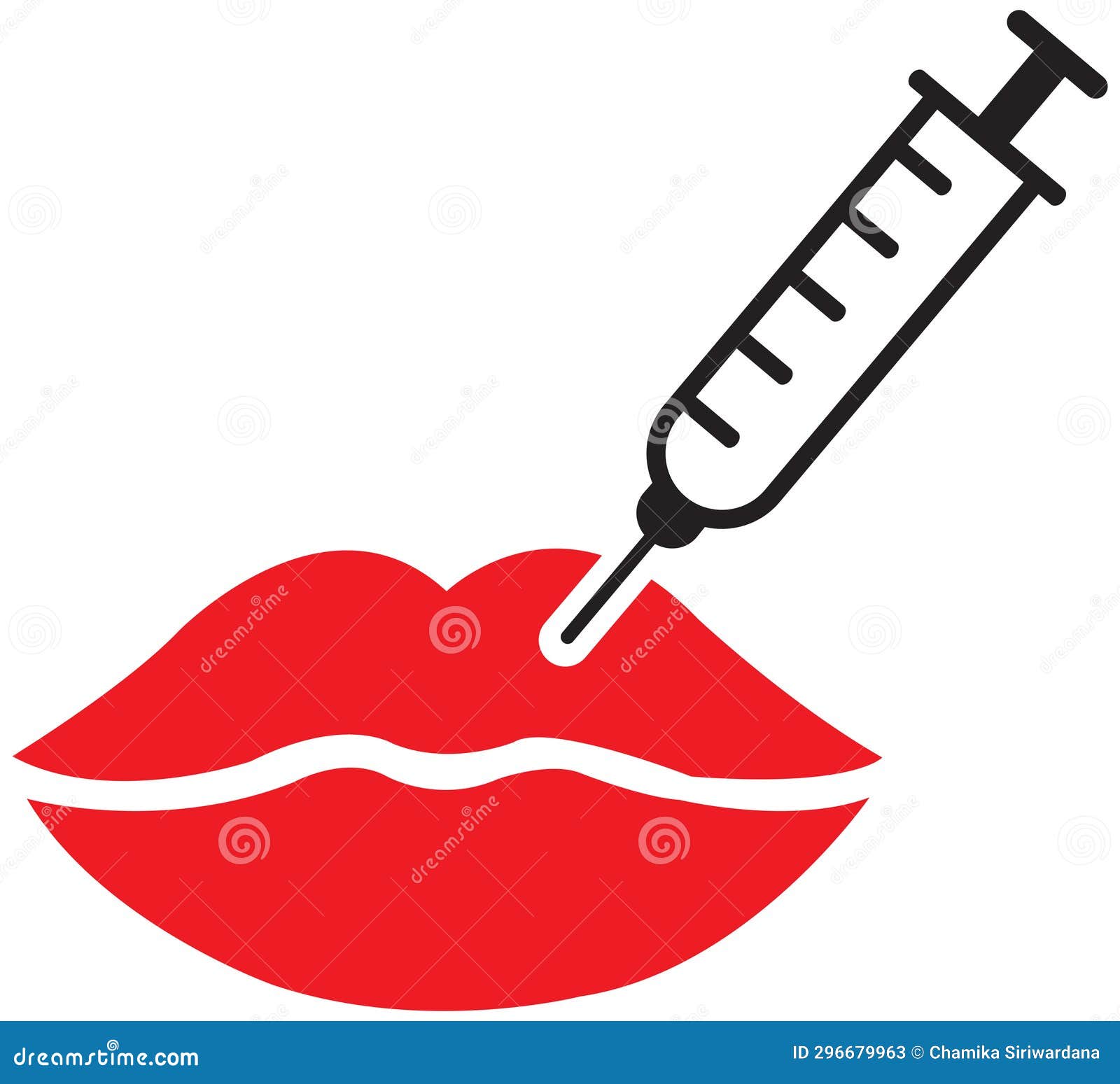 Lip Augmentation. Lip Filler Injection Stock Vector - Illustration of ...