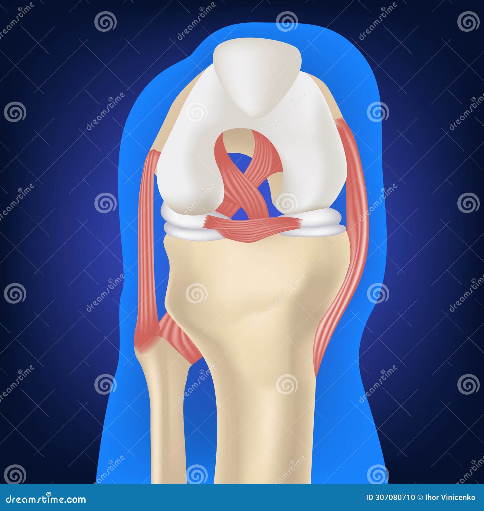 Cruciate Ligament, Leg Bones on a Blue Background. Stock Vector ...
