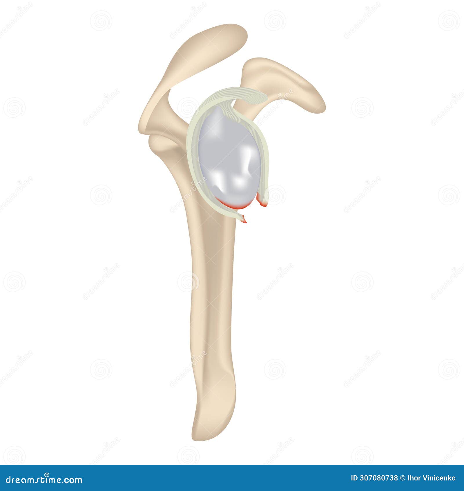 Clavicular Joint. Labrum Injury. Realistic Rendering of the Collarbone ...