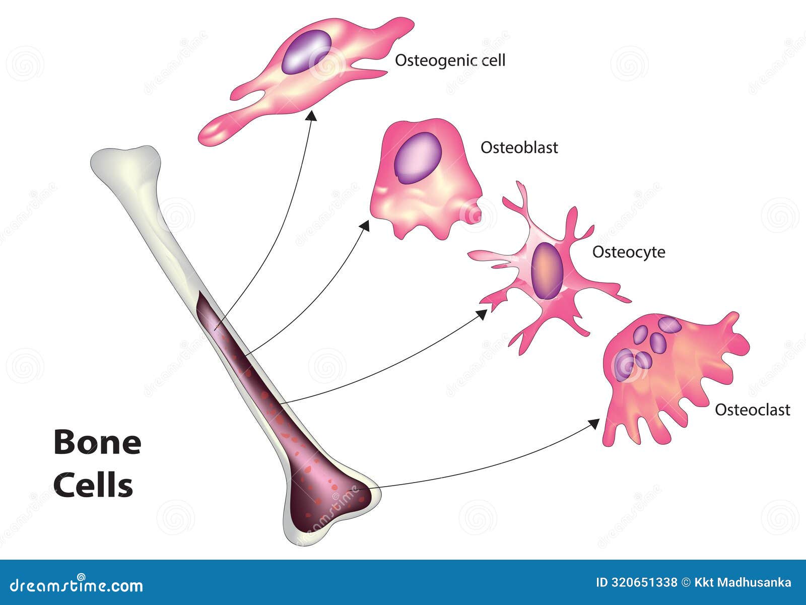 Bone cell classification stock vector. Illustration of cancer - 320651338