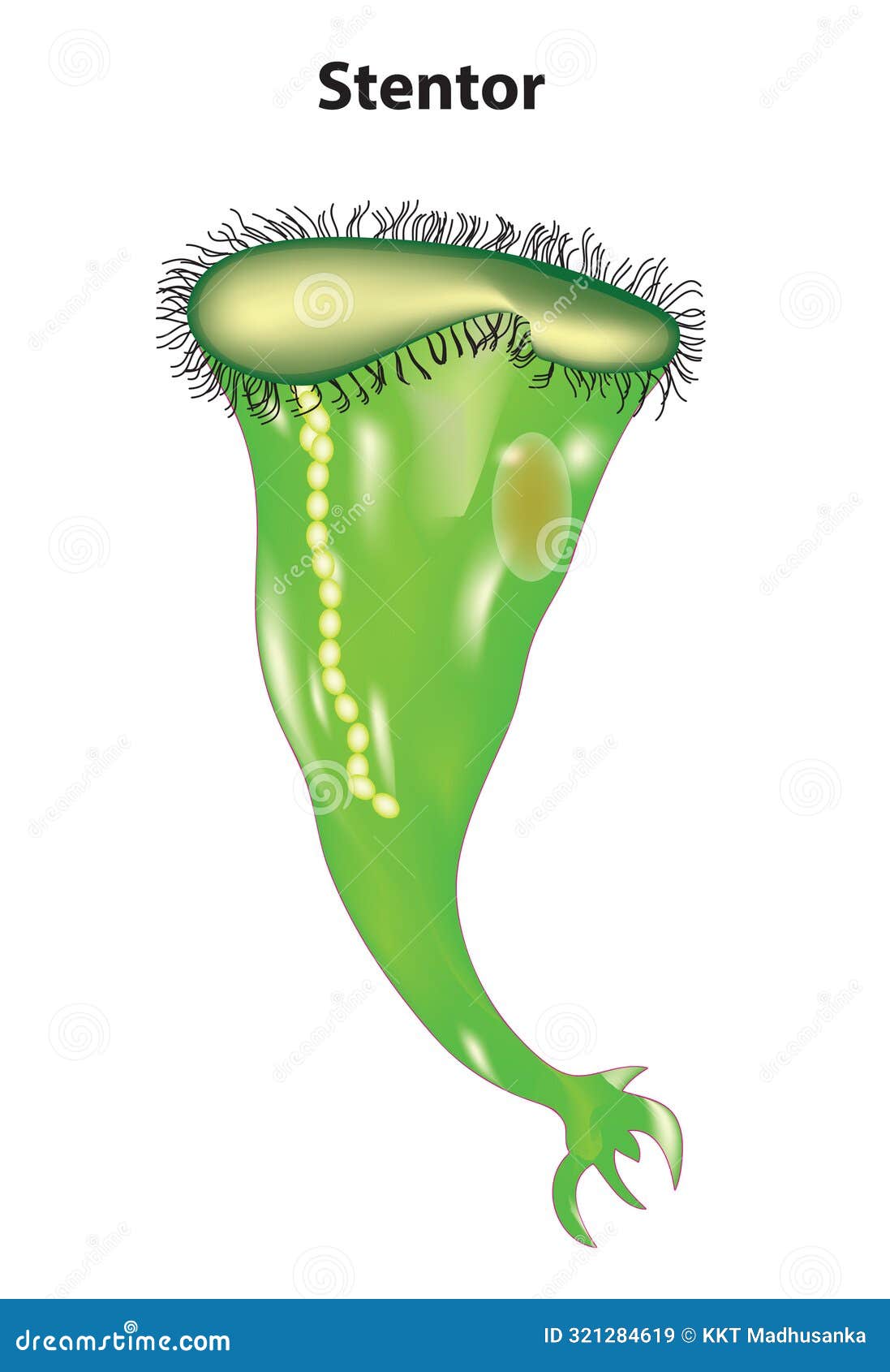Stentor Diagram