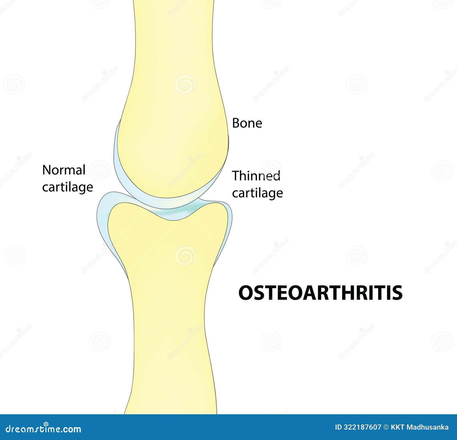 Deformity And Life - Pictured As A Word Deformity And A Wreck Ball To ...