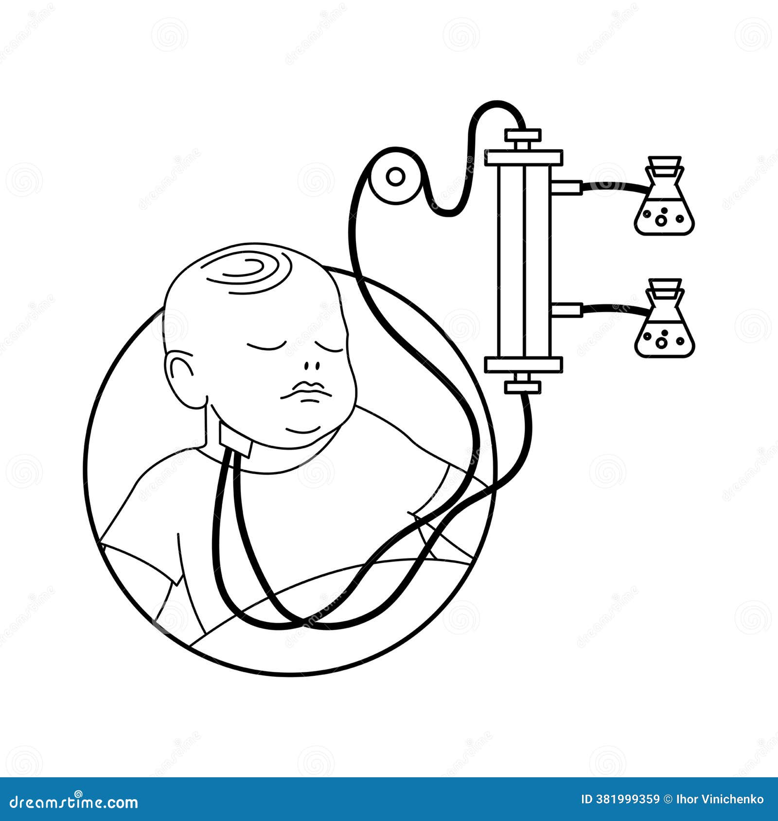 Infant Hemodialysis. Connecting A Child To A Hemodialysis Machine ...