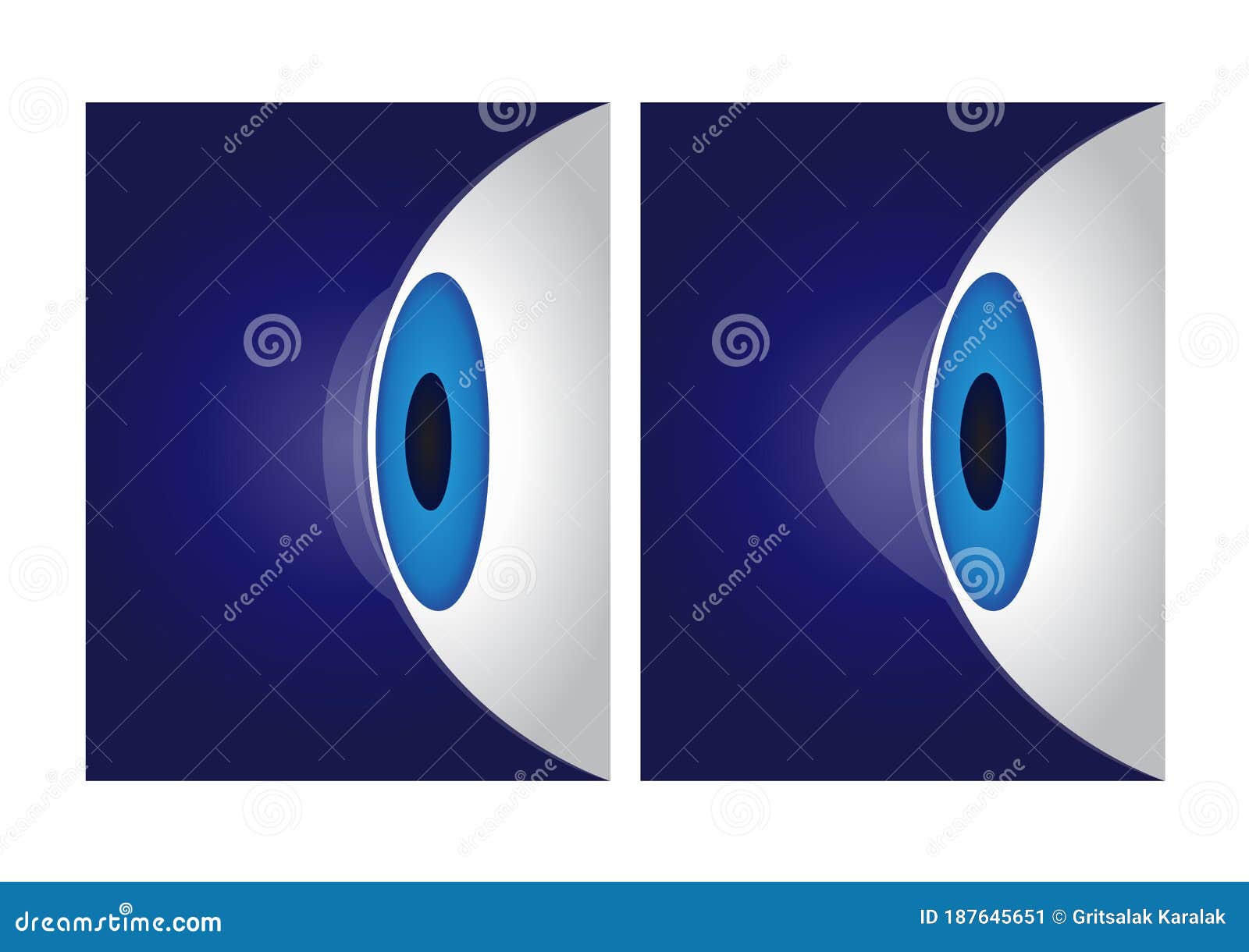 Eye Cornea and Keratoconus Vector / Anatomy Stock Vector - Illustration ...