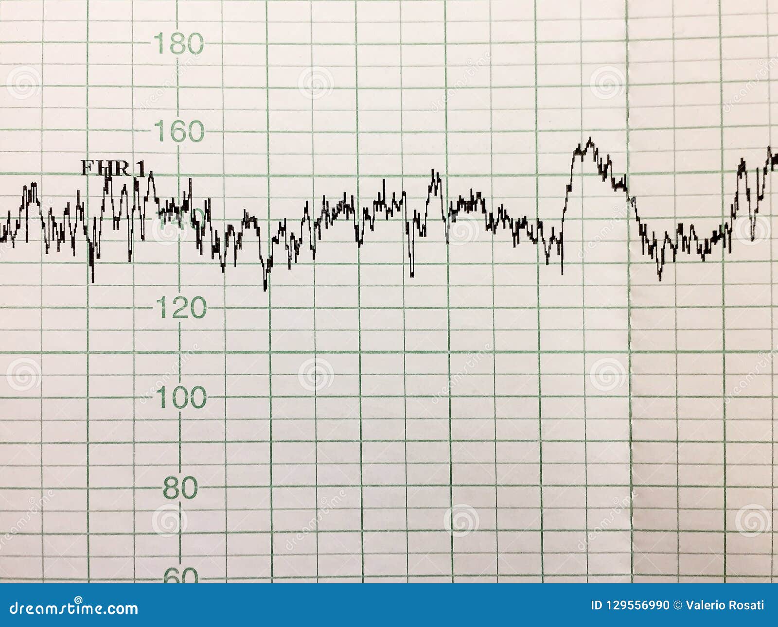 Printing of Cardiogram Report Stock Photo - Image of diagram ...