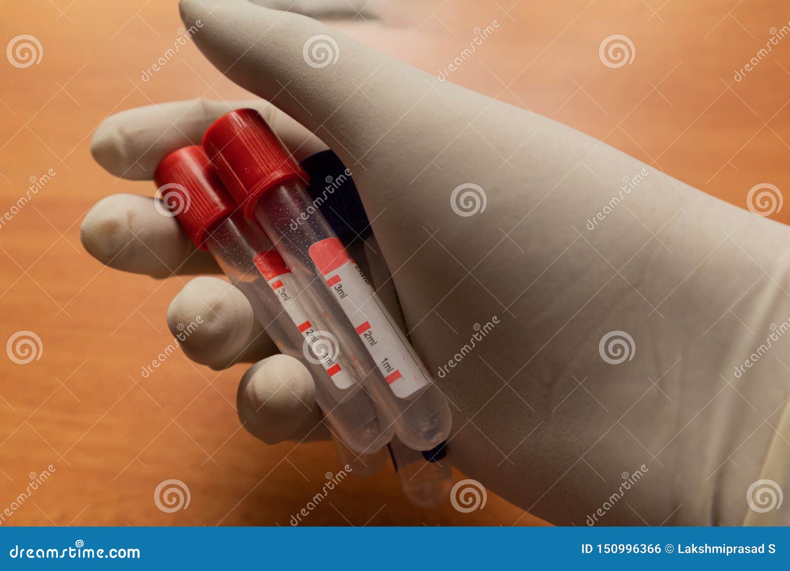 Pro-coagulation Plain Clot Activator Blood Collection Tubes,with Red ...