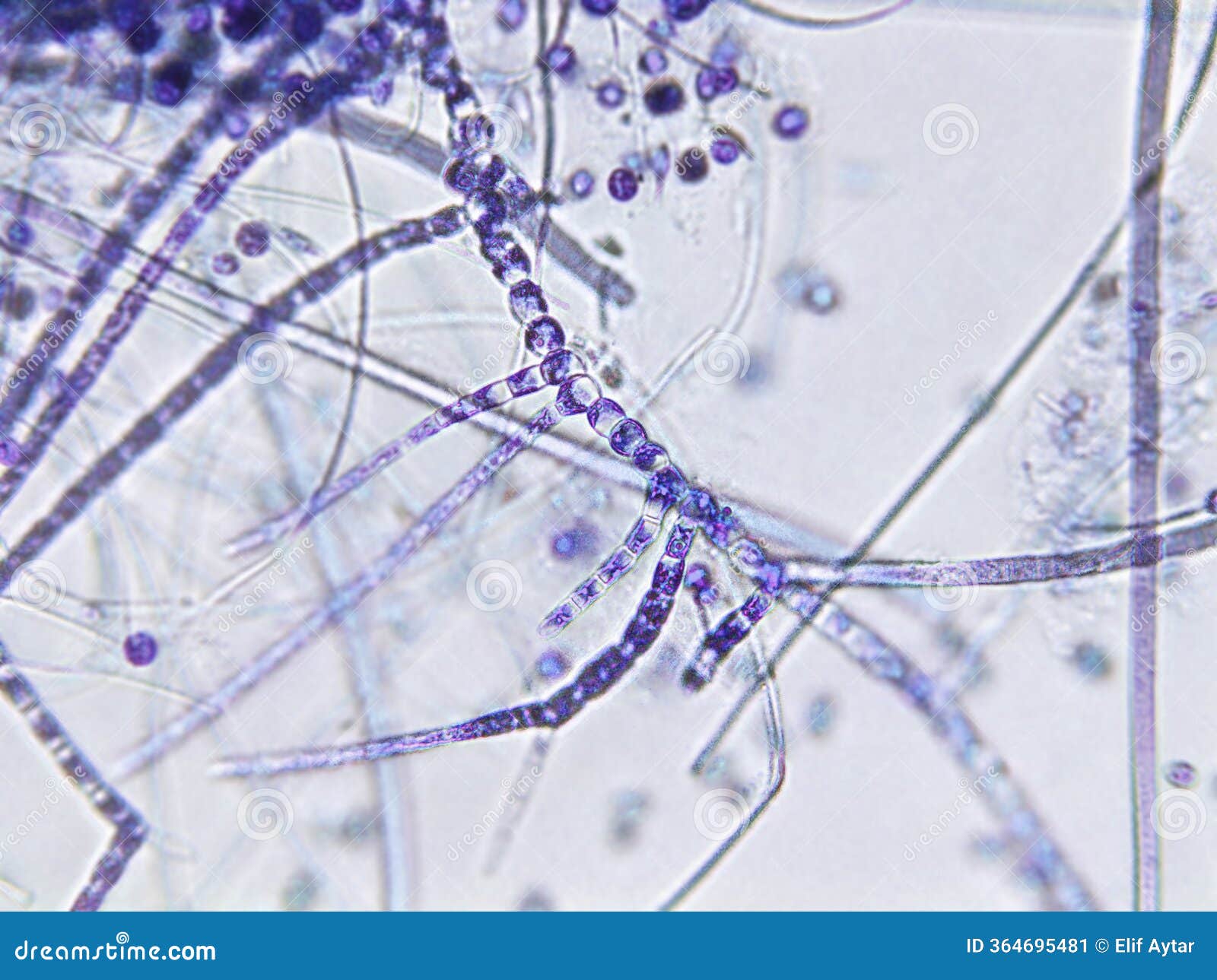 Probiotics, Lactic Acid Bacteria. Algae, Bacteria And Microorganisms ...