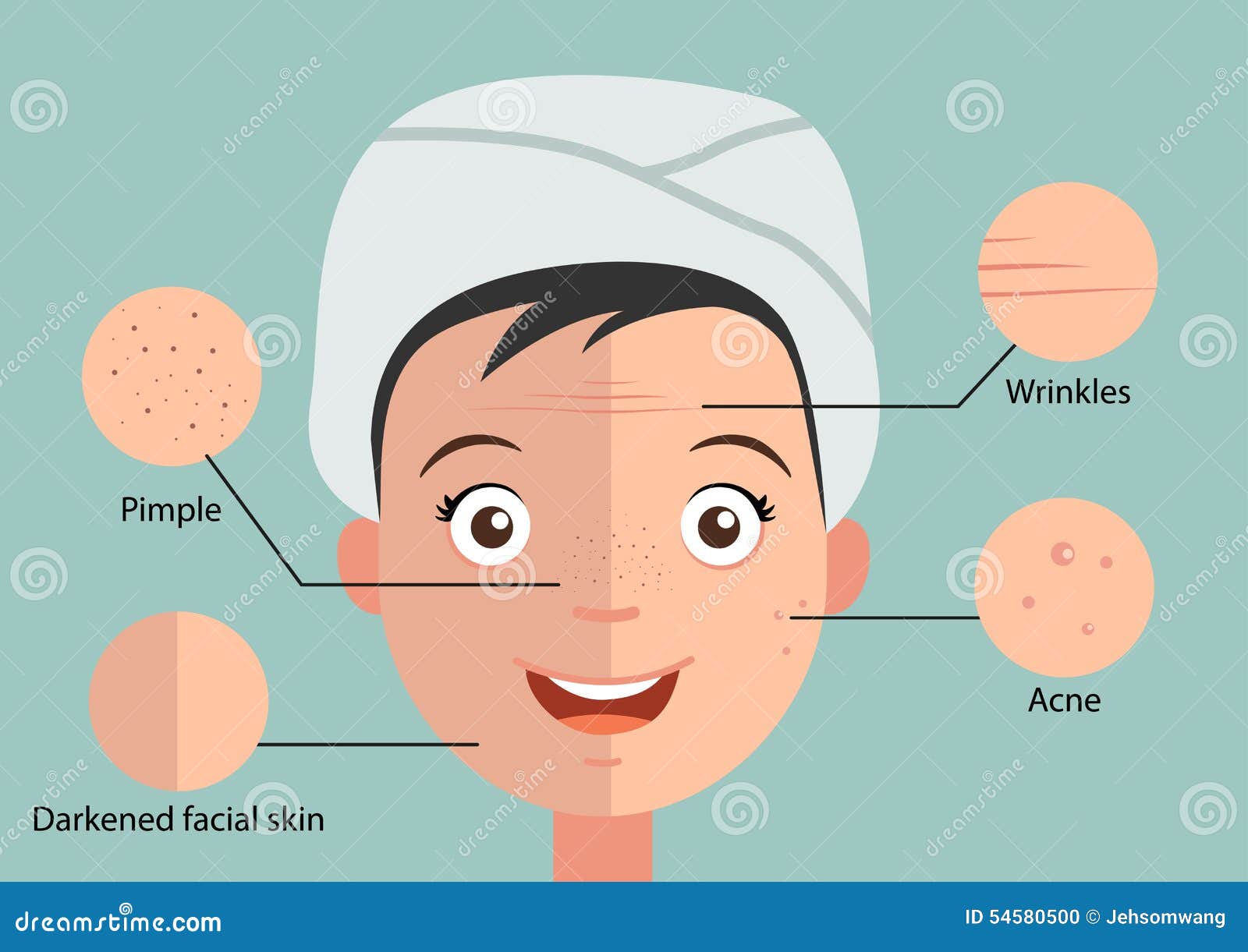 Problem skin stock vector. Illustration of scar, rash - 54580500