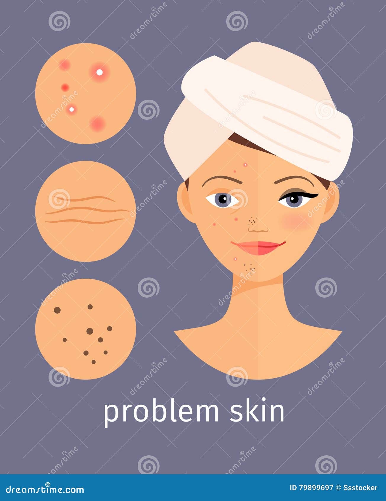 Man Problem Skin Infographic. Stop Acne Educational Poster. Causes ...