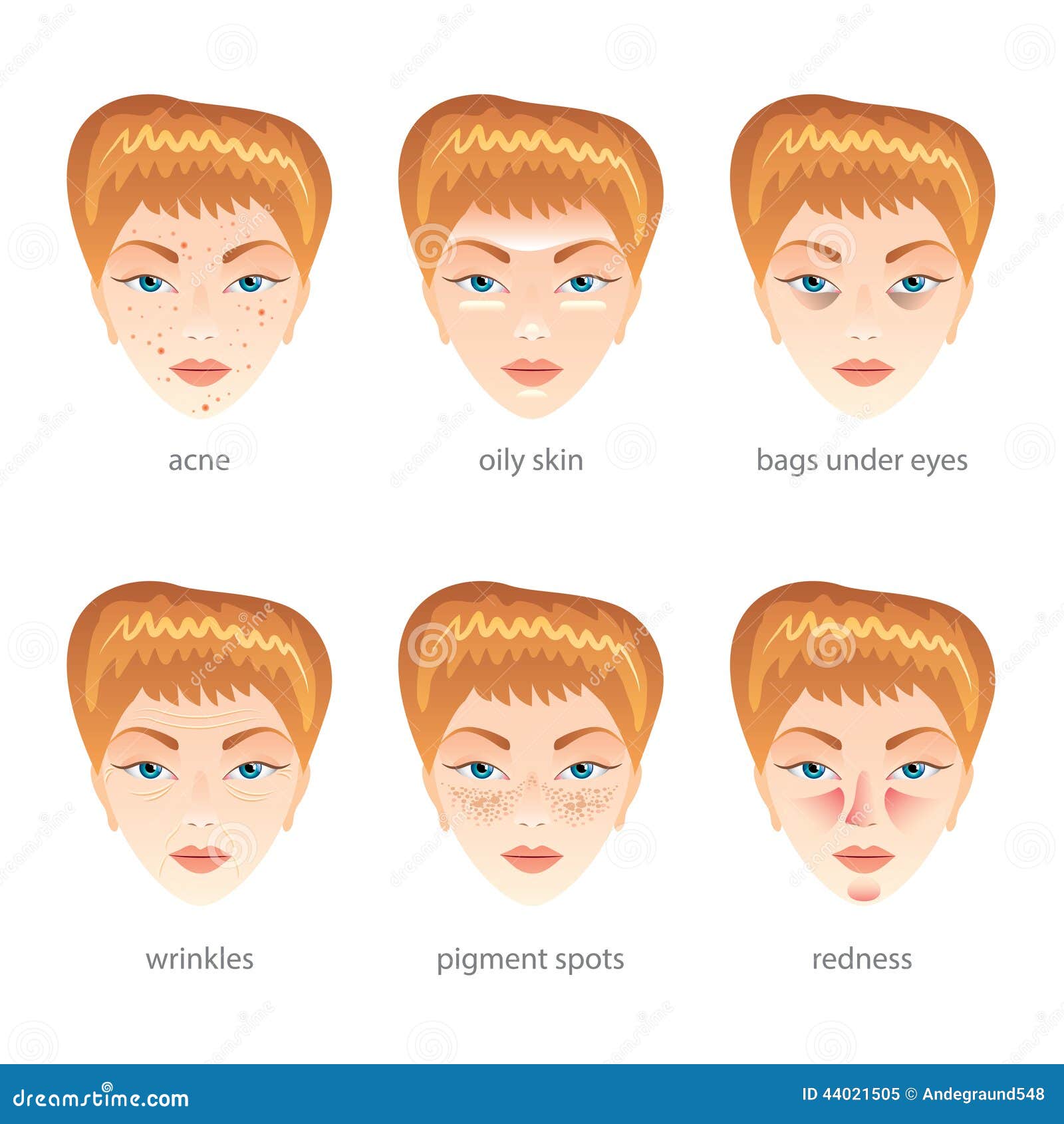Problem skin vector set stock vector. Illustration of head - 44021505