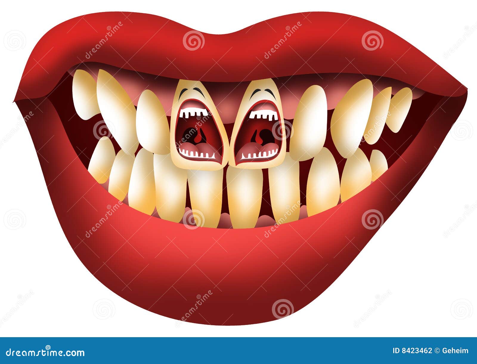 Problem Teeth Screaming for Help Stock Illustration - Illustration of ...