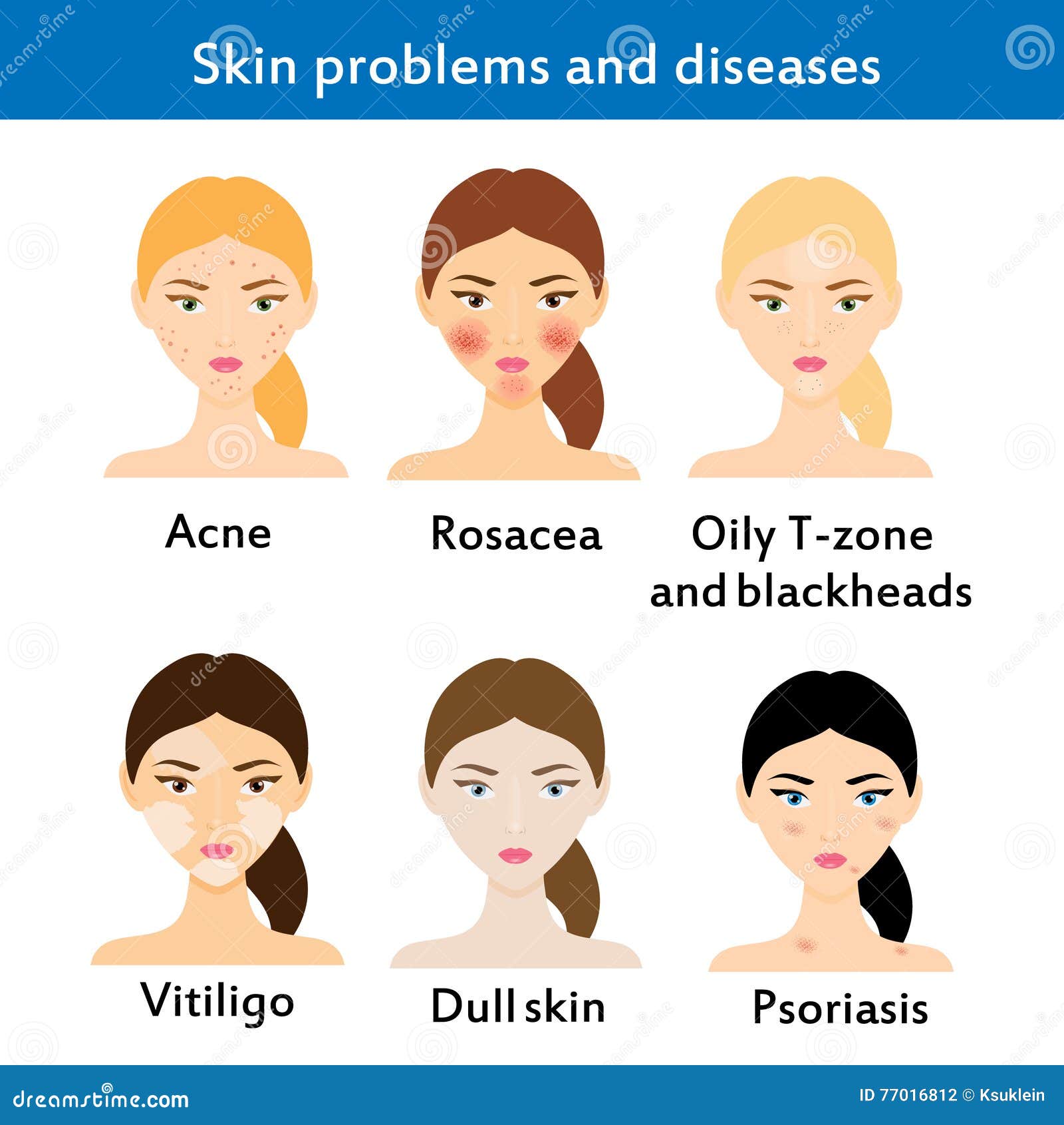 Problemas Y Enfermedades De Piel Ilustración del Vector - Ilustración ...